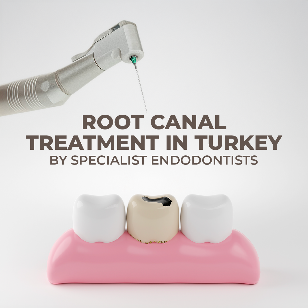 Root Canal Treatment in Turkey | Specialist Endodontists at VIP Dental ...